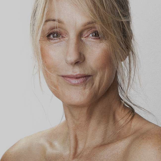 Lifting cervico facial ou lifting du visage à Paris| Dr Obadia